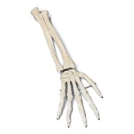Functional Hand & Wrist Joint (right)
